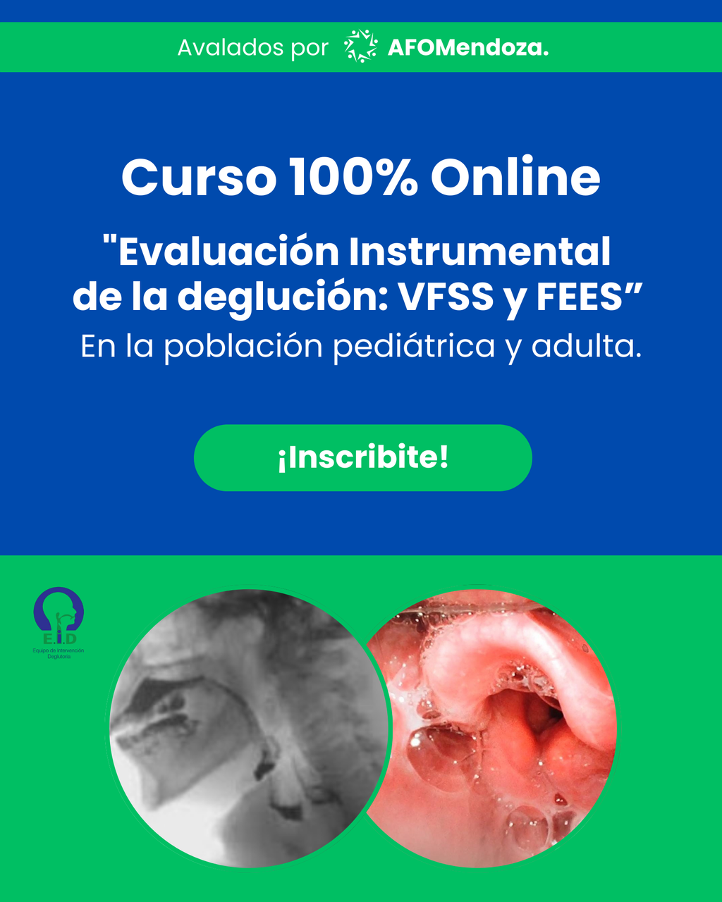 "Evaluación Instrumental de la Deglución: VFSS y FEES" - EID-Disfagia ...